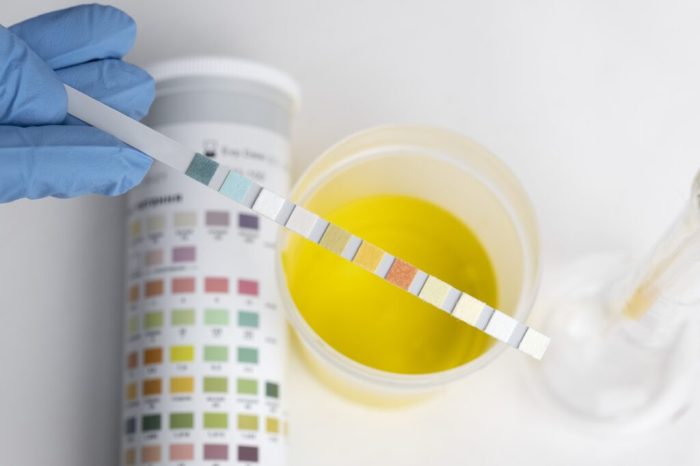 Cara Menghitung Urine Normal Panduan Lengkap Untuk Kesehatan Anda - Identif